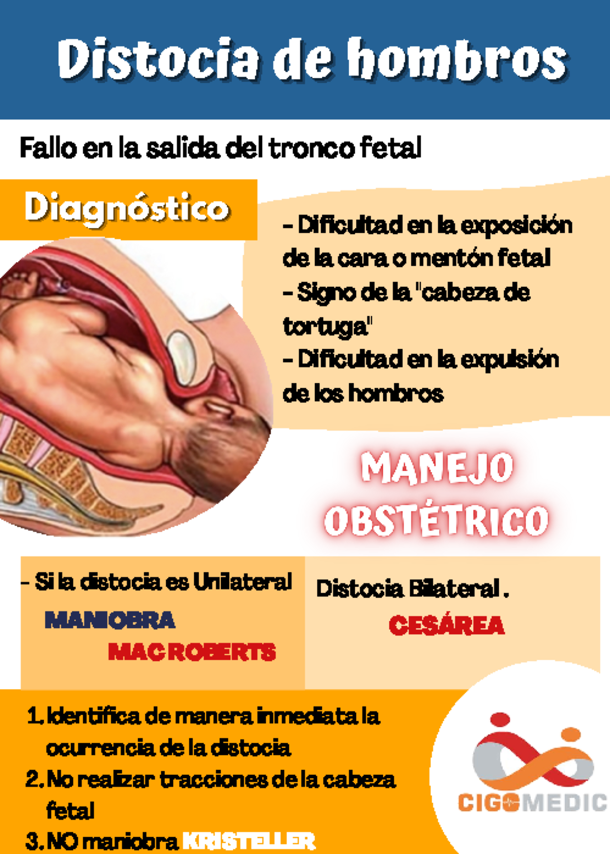 Distocia DE Hombros - OBSTETRICIA - Dificultad en la exposición de la ...