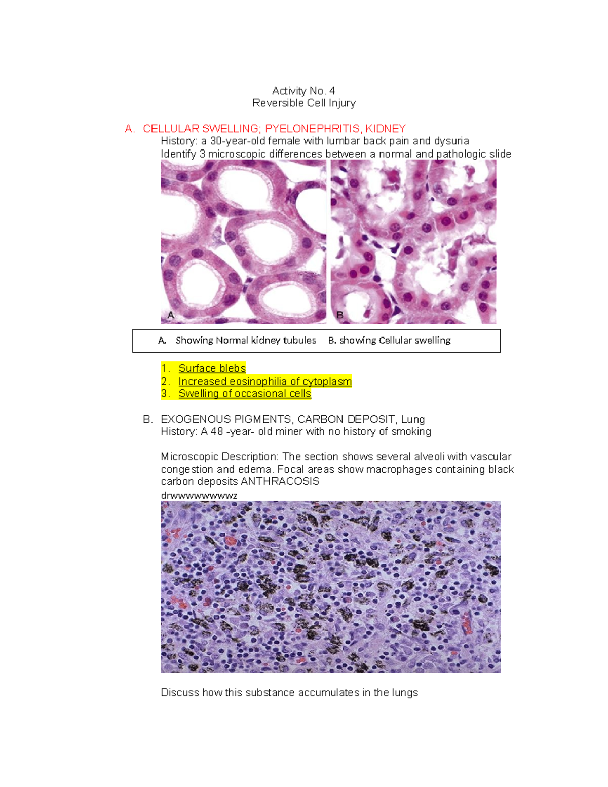 Activity 4 Reversible Cell Injury - Activity No. 4 Reversible Cell ...