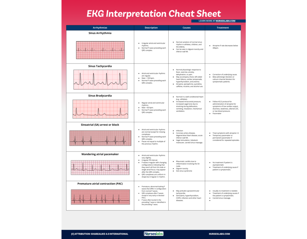 EKG-Interpretation-Cheat-Sheet-for-Heart-Arrhythmias Nurseslabs 1 - Studocu