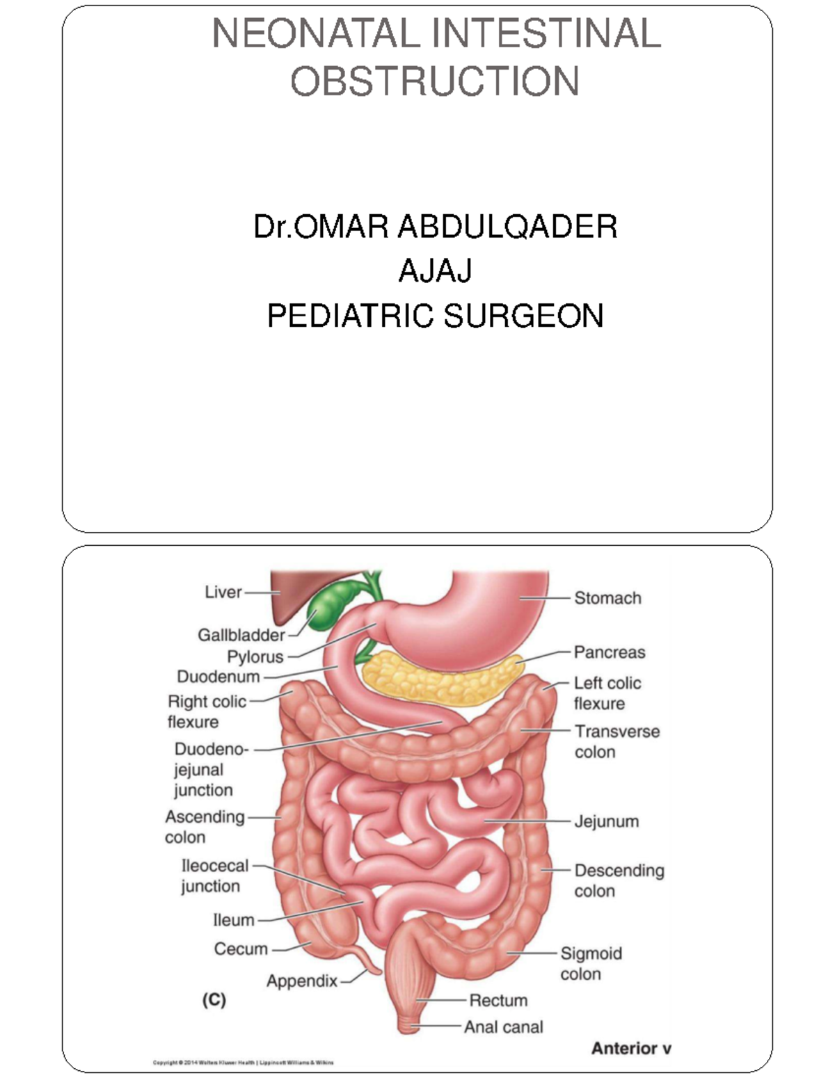 Neonatal Intestinal Obstruction - NEONATAL INTESTINAL OBSTRUCTION Dr ...