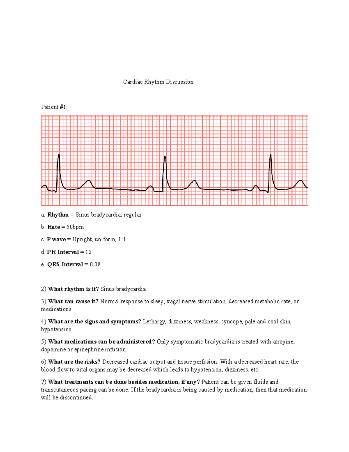 Discussion Board Perfusion Cardiac Rhythms - Cardiac Rhythm Discussion ...