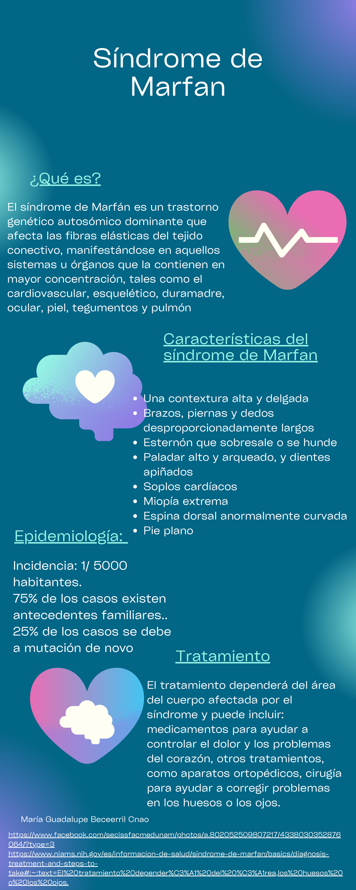 Síndrome de Marfan - Síndrome de Marfan María Guadalupe Beceerril Cnao ...