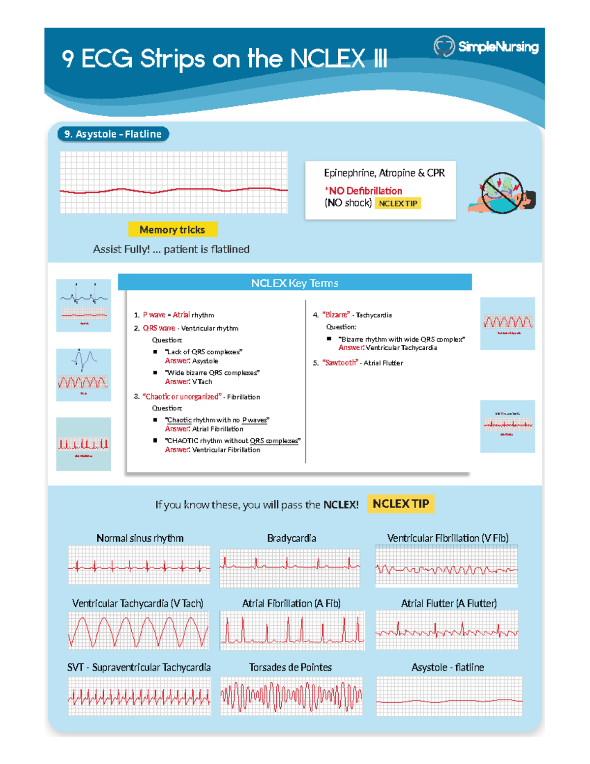 Ekg visuales mca 3 - ekg - 9 ECG Strips on the NCLEX III 3. Normal sinus rhythm Ventricular ...