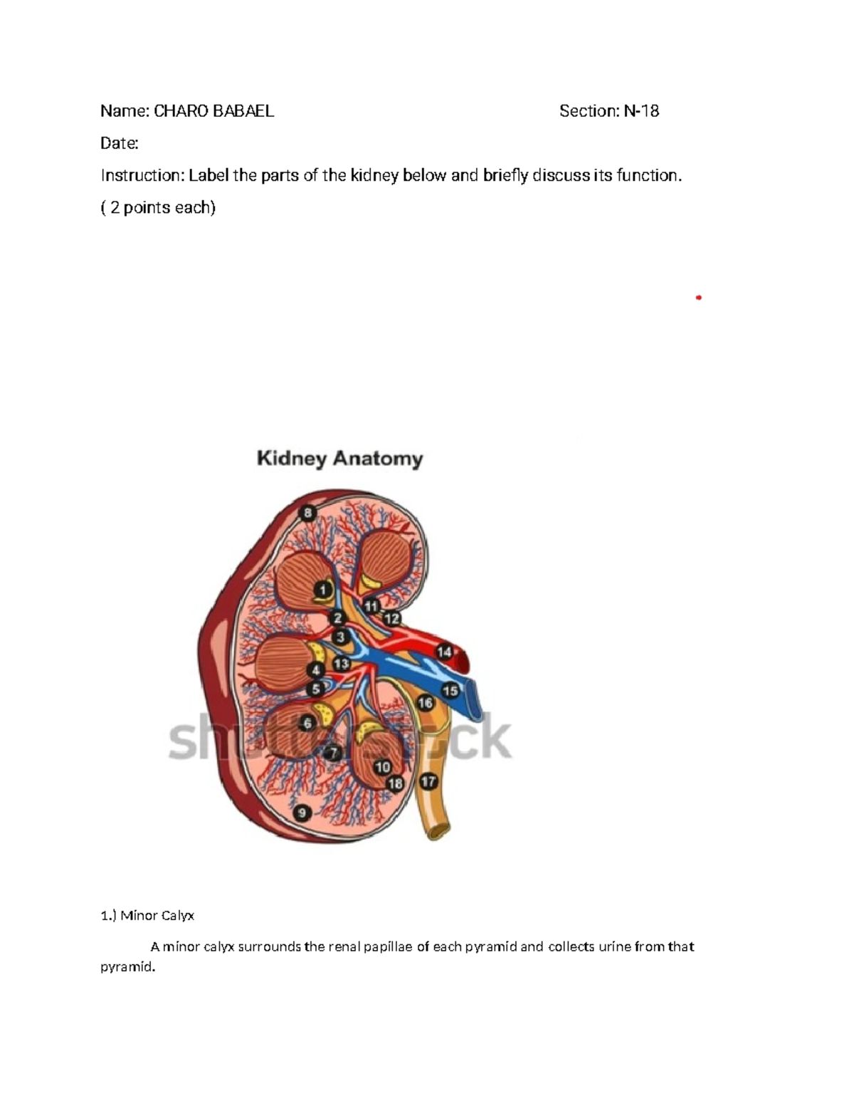 Urinary System Elaborate Laboratory answer - Name: CHARO BABAEL Section ...