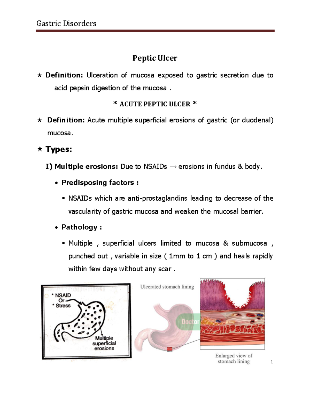 PU acute - internal medicine - Peptic Ulcer Definition: Ulceration of ...