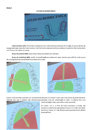 PPR - tipos de grampos - AULA 10 Grampos circunferenciais 1 ...