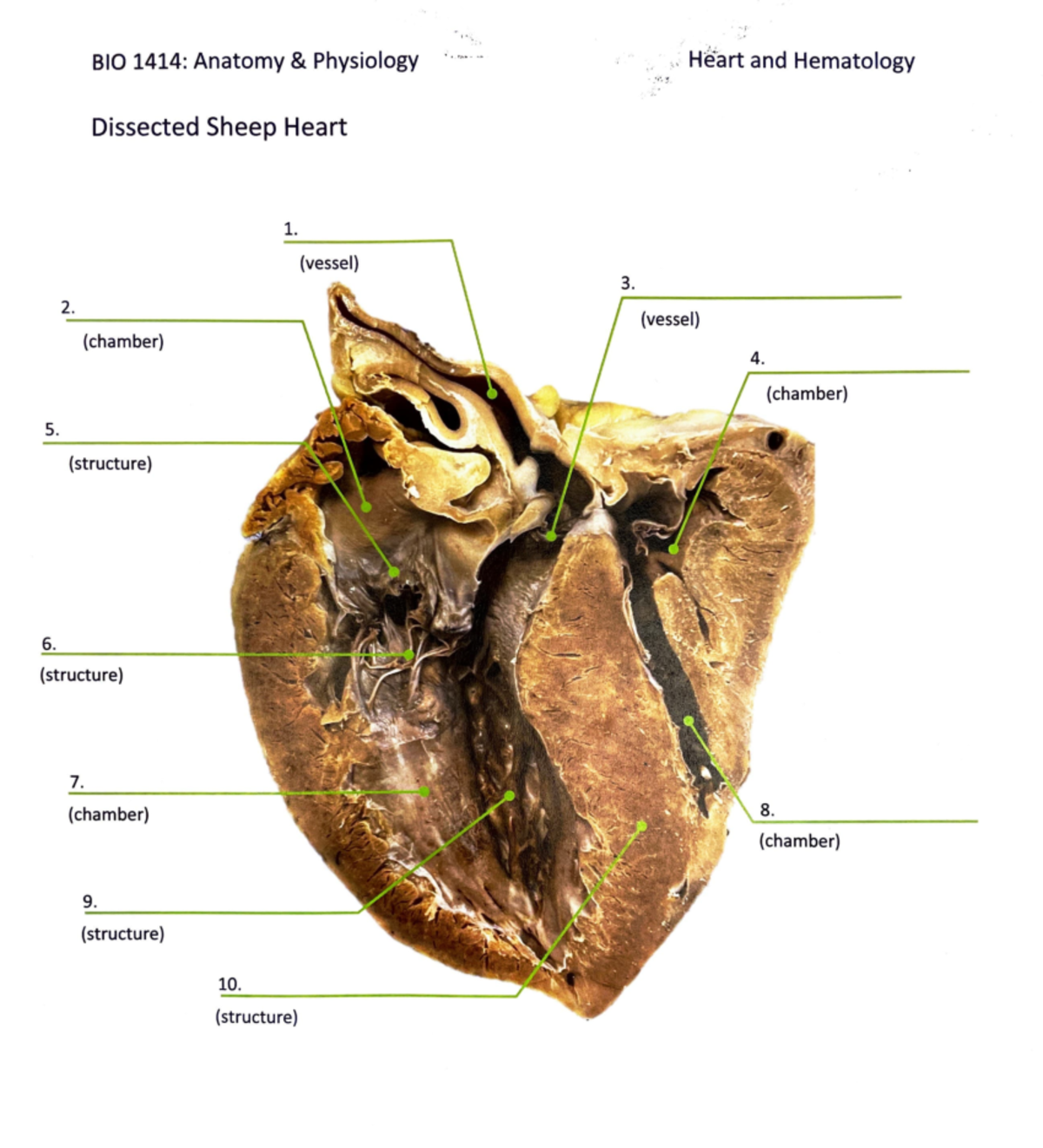 Heart-practice - Heart practice - BIO 1414: Anatomy & Physiology ...