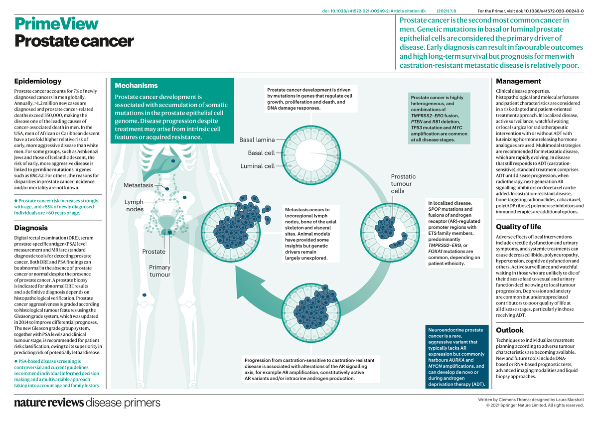 Ca+Prostata+2 - Describe como es el cancer de próstatas en los varones ...