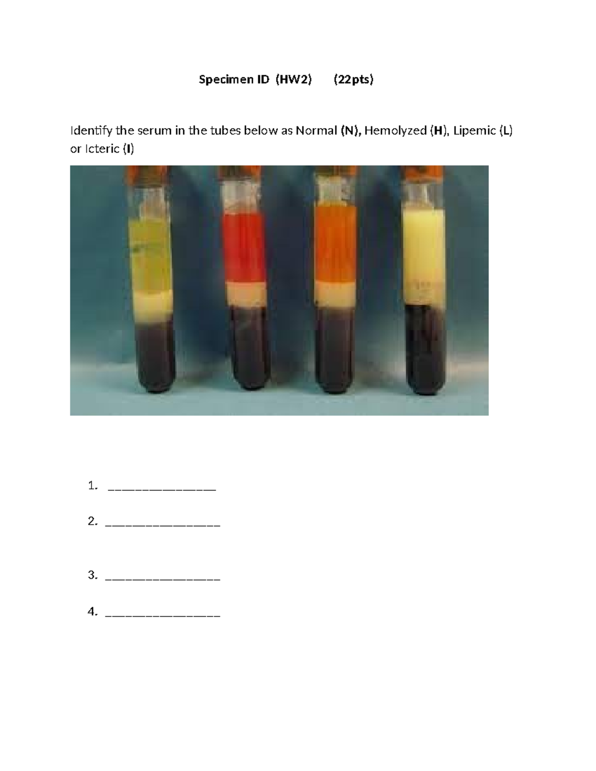 Specimen ID HW 2 W23 - Specimen ID (HW2) (22pts) Identify the serum in ...