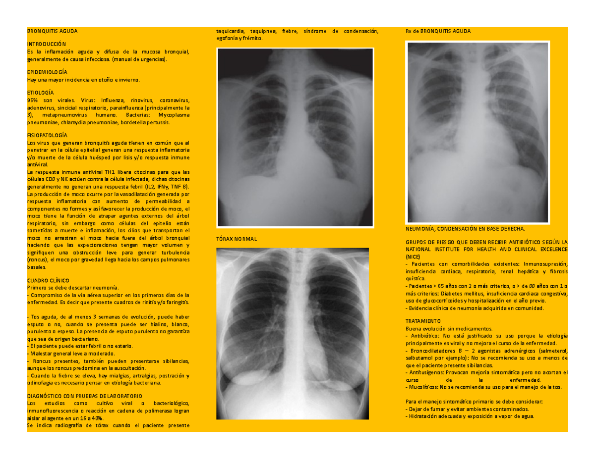 Bronquitis Aguda - BRONQUITIS AGUDA INTRODUCCIÓN Es la inflamación ...