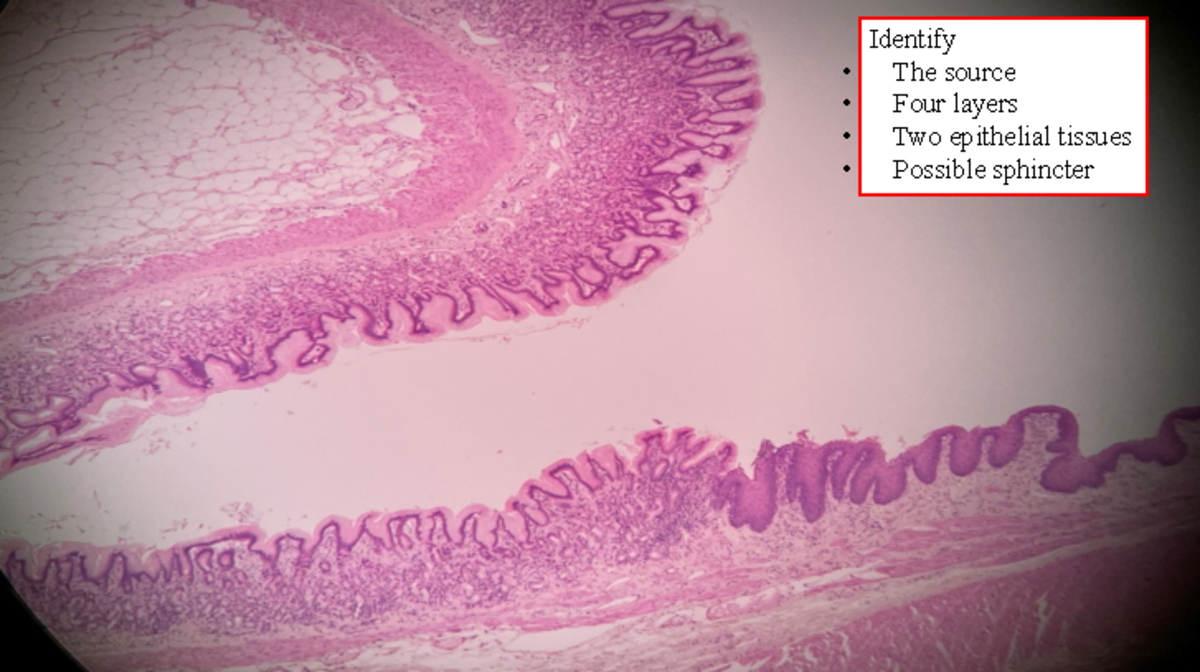 Digestive Histology - The source Four layers Two epithelial tissues ...