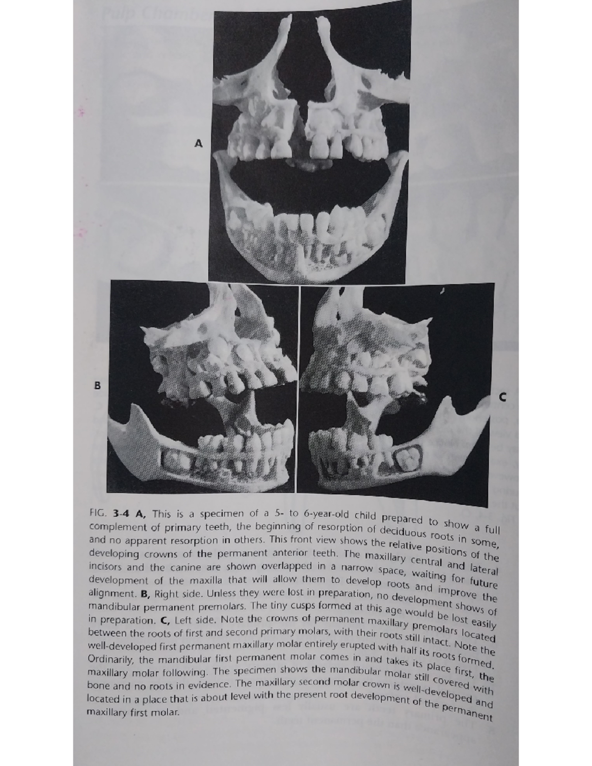 20221113 094142 - The primary (deciduous )Teeth - Anatomy and Human ...