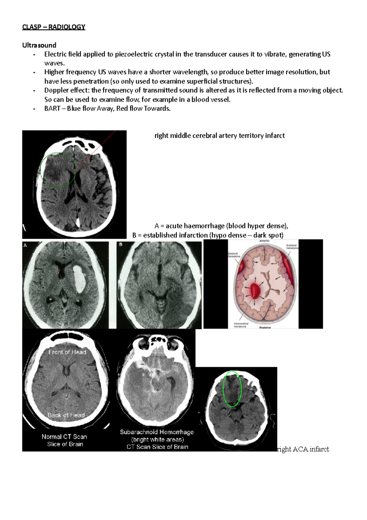 Clasp-radiology - An in depth overview of the entitled topic - CLASP ...