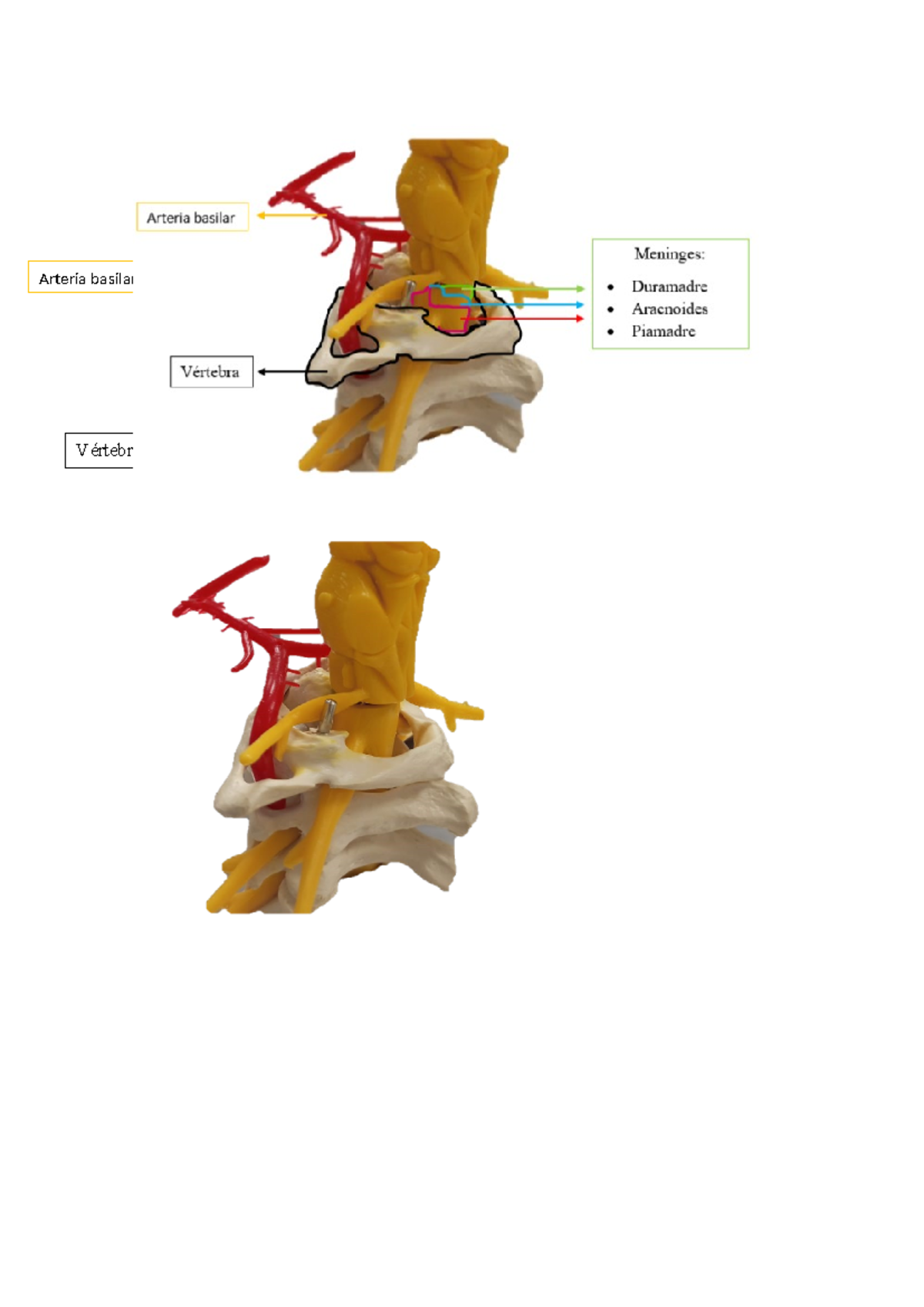 Imagenes de practica 1 - imágenes - Anatomia I - Meninges: Duramadre ...