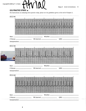 ACS- Angina vs AMI - n/a - NURS 2211 - Studocu