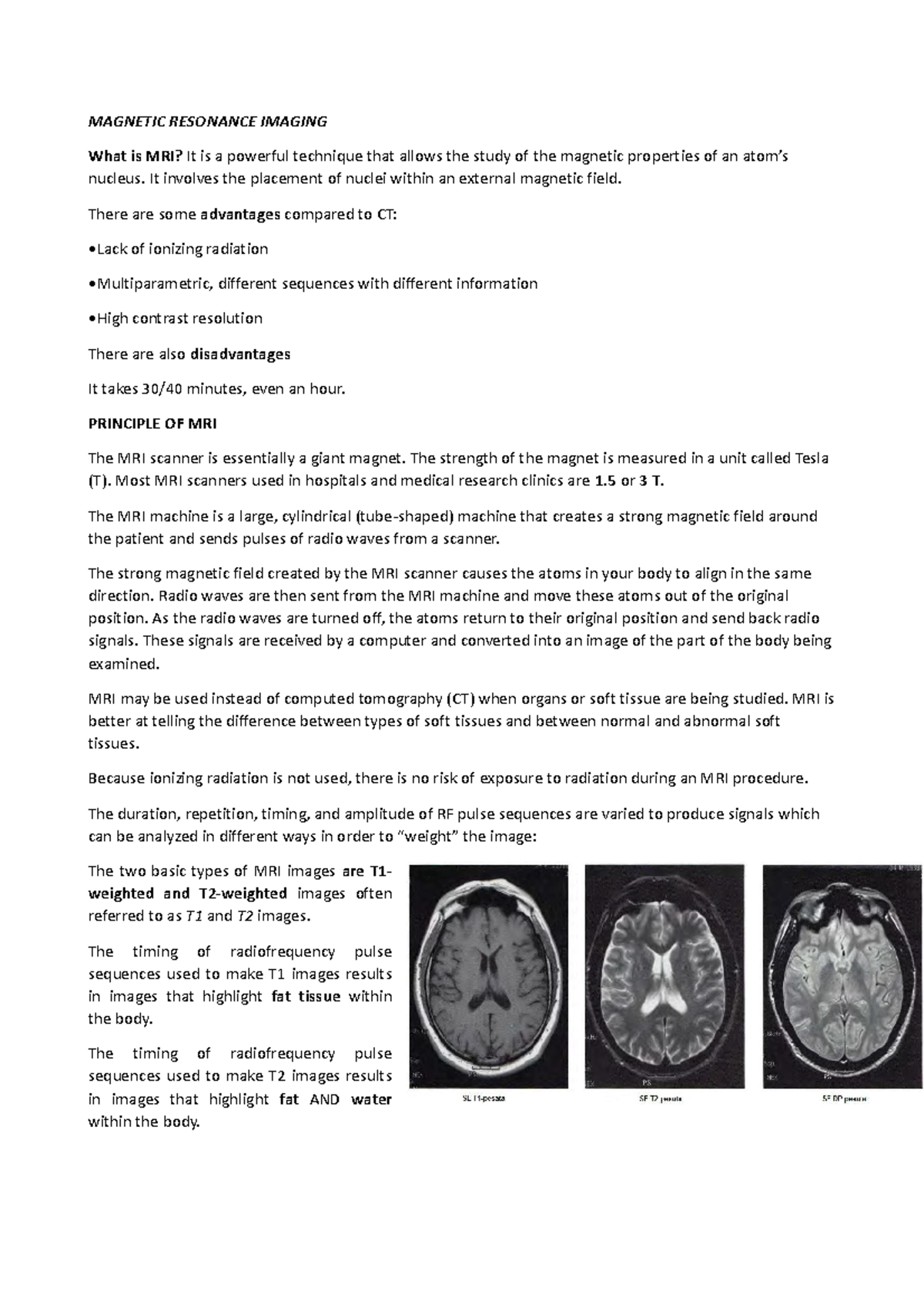 MRI - MRI - MAGNETIC RESONANCE IMAGING What is MRI? It is a powerful ...