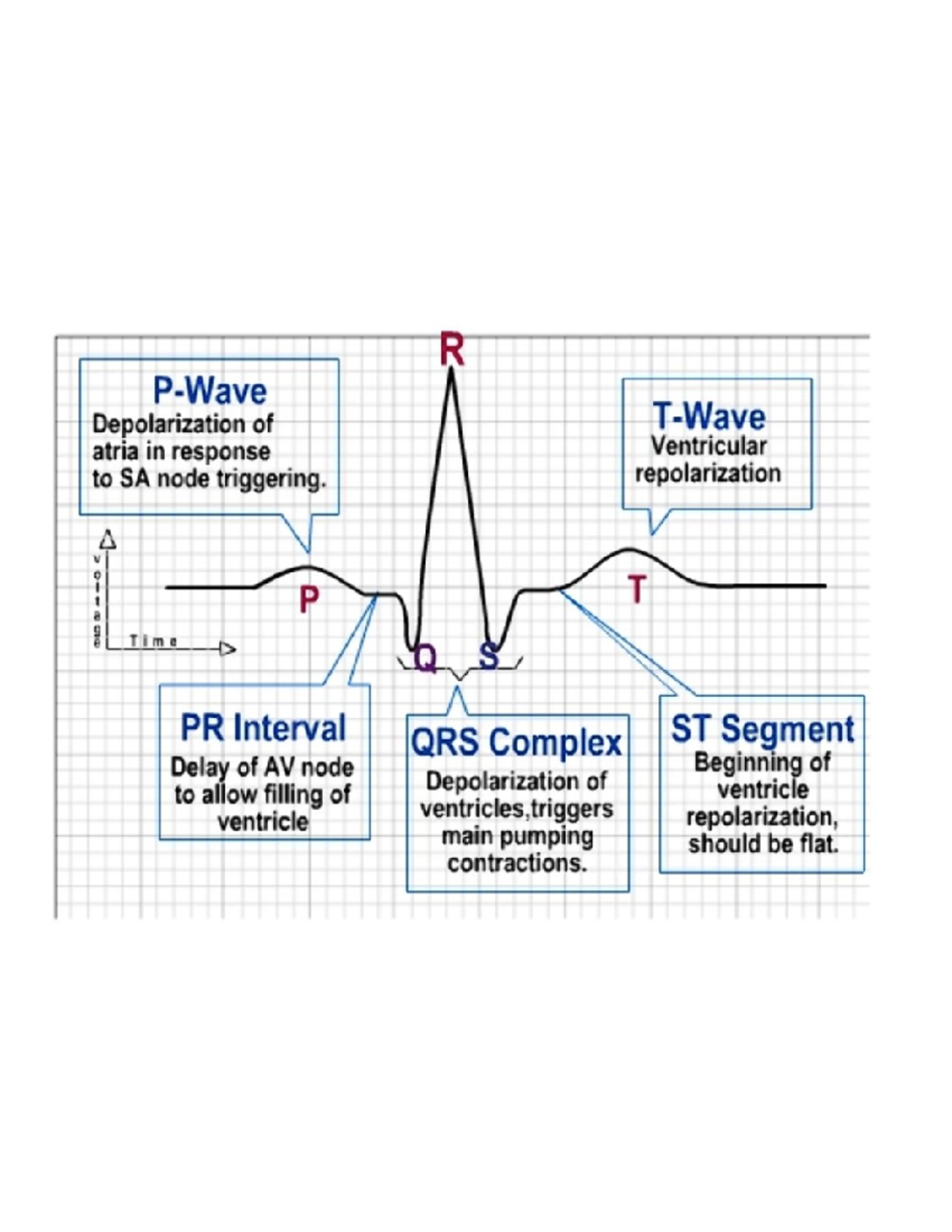 Waveform overview - NURS 1101 - Studocu