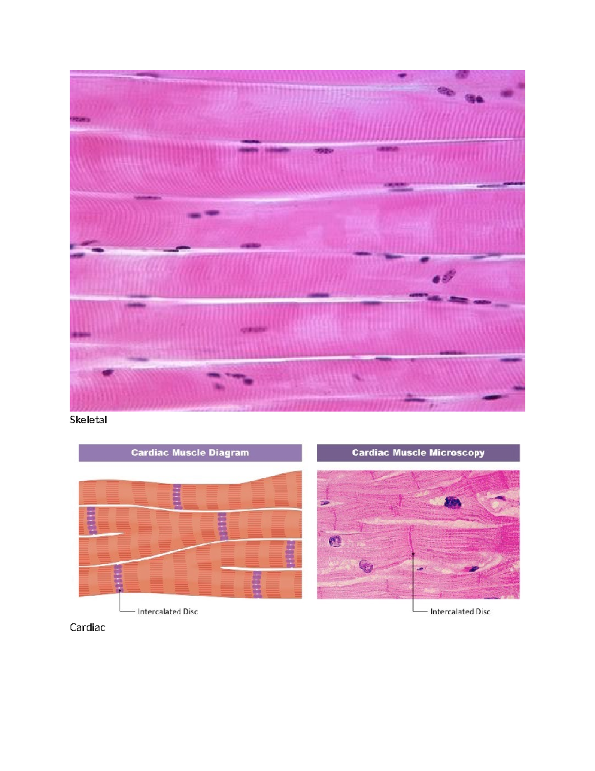Muscle tissue - PSYC 200 - Skeletal Cardiac Muscle Diagram Cardiac ...