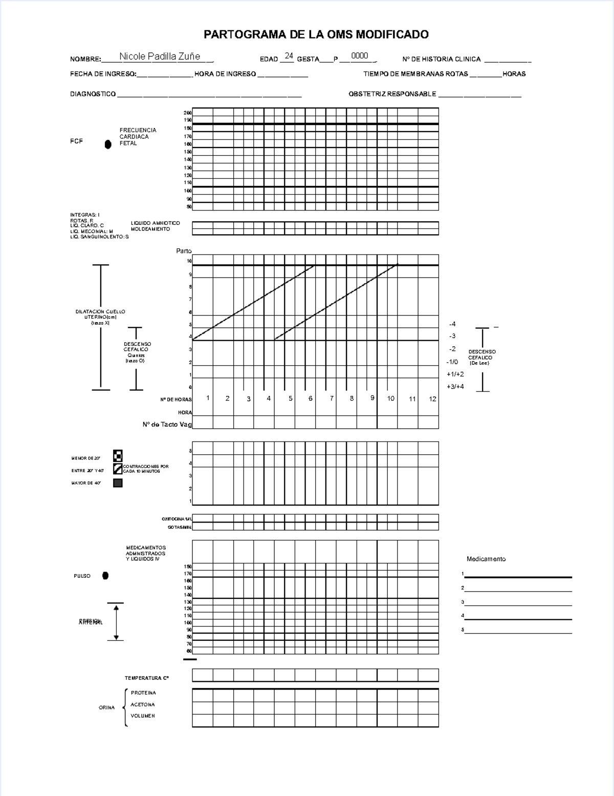 Partograma Modelo - TRABAJO DE PARTO Y PATOLOGIAS - GESTA____P ...