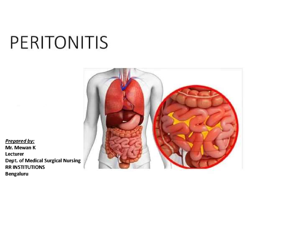 Peritonitis - One of the important topic in AHN - Prepared by: Mr ...