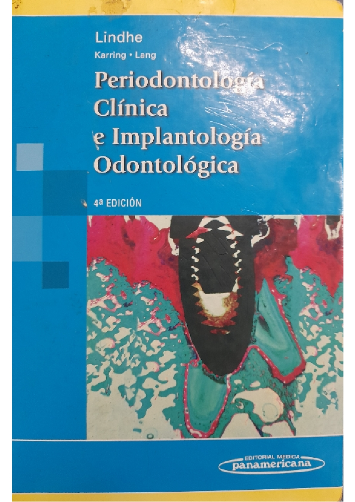 1° Parcial Perio - Lindhe Karring . Lang Periodontolo Clínica e ...