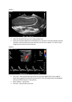 Basic Ultrasound Terminology - BASIC ULTRASOUND TERMINOLOGY ANECHOIC ...