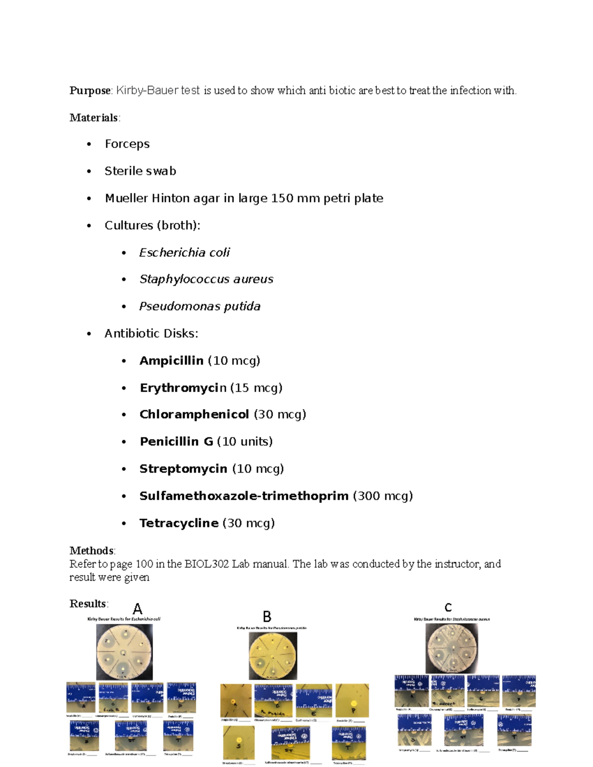 Kirby - Purpose : Kirby-Bauer test is used to show which anti biotic ...