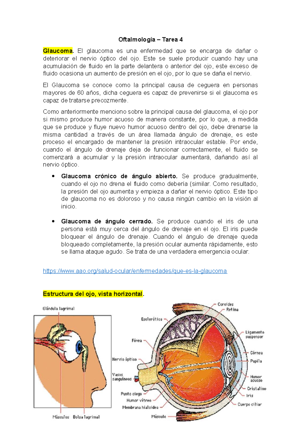 Glaucoma Tarea Ofta - Oftalmología – Tarea 4 Glaucoma. El glaucoma es una enfermedad que se ...