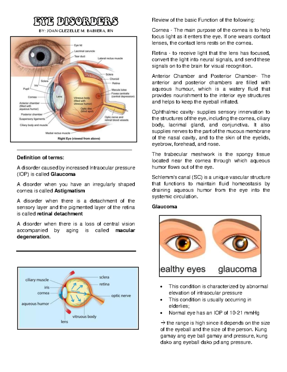 EYE Disorders with notes - BY: JOAN GLEZELLE M. BABIERA, RN Definition ...