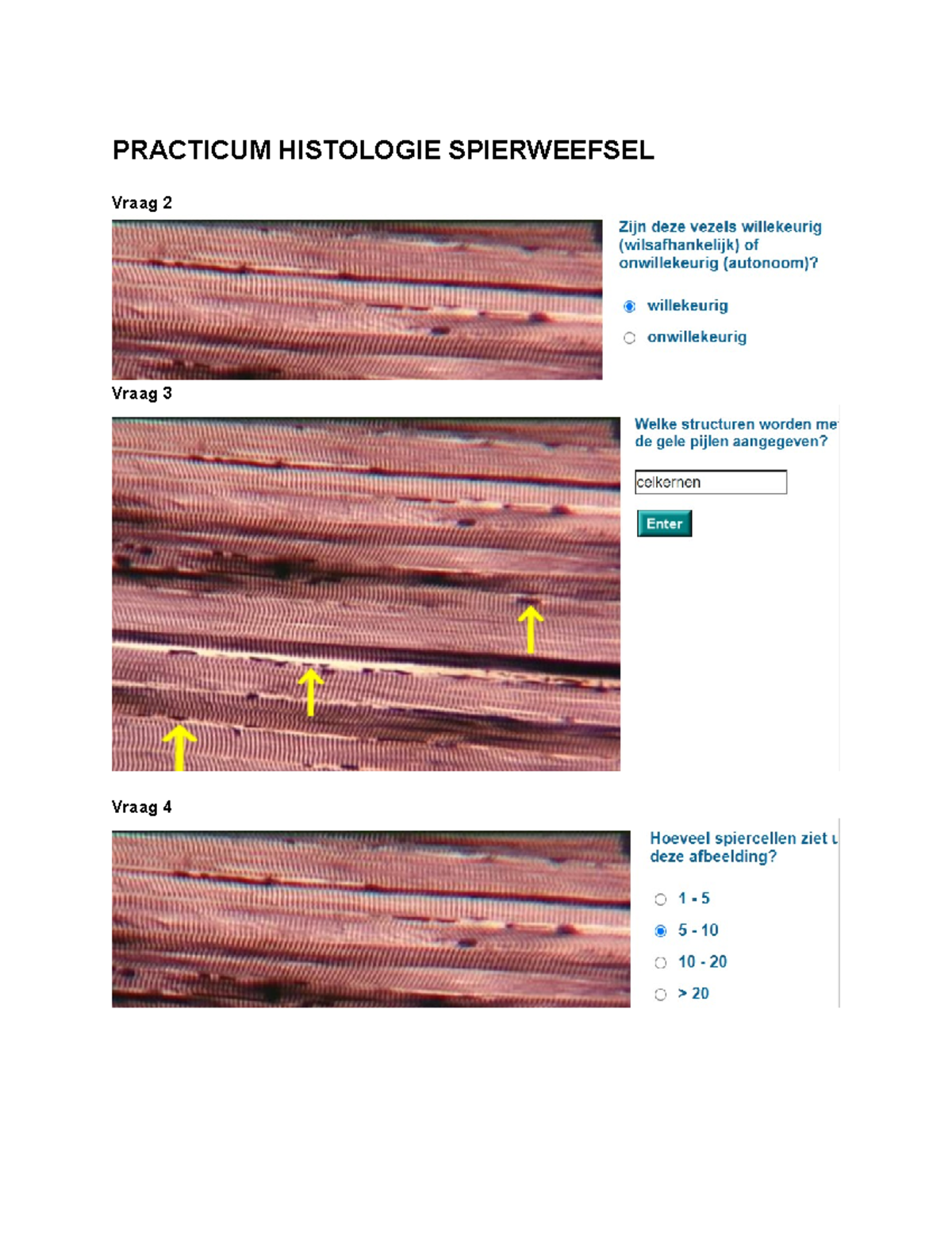M8- anatomie en pathologie ~ Practicum histologie spierweefsel 2020 ...