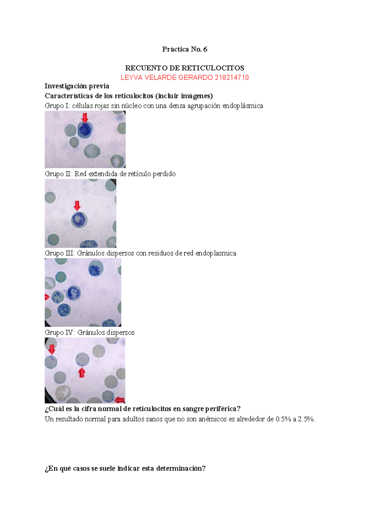 P6 recuento reticulocitos - Práctica No. 6 RECUENTO DE RETICULOCITOS ...