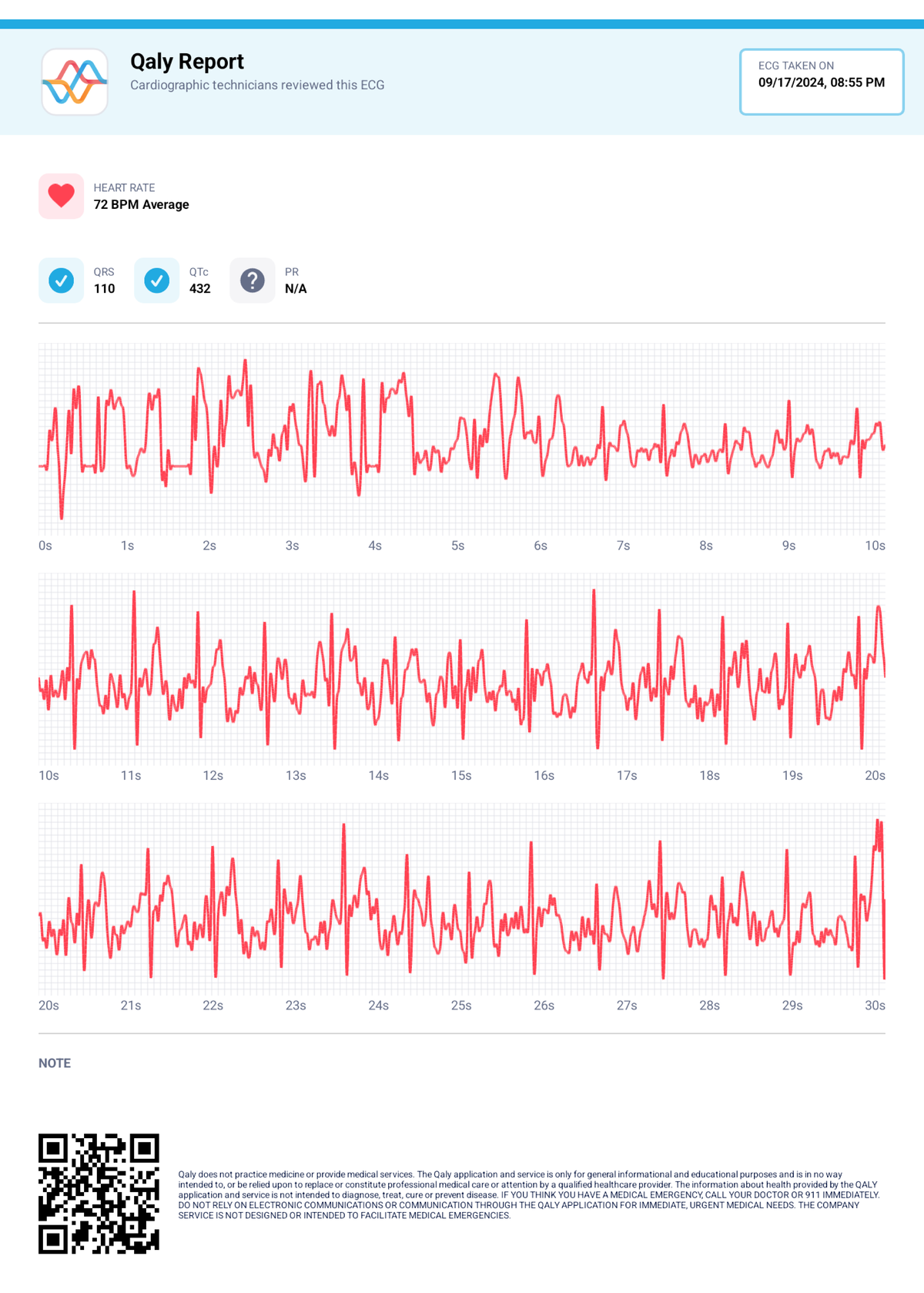 My ECGOn Sep 18 2024 01 55 - Qaly Report ECG TAKEN ON Cardiographic ...