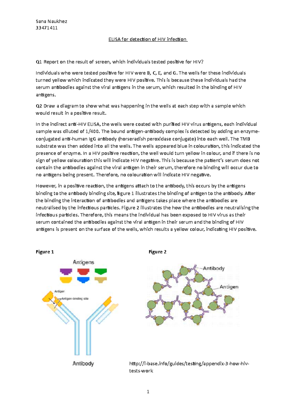 Elisa for detection of HIV infection - 33471411 ELISA for detection of ...