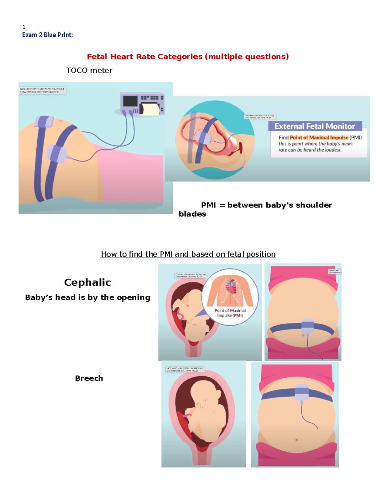nursing - OB/Maternity study guide - Exam 2 Blue Print: Fetal Heart ...