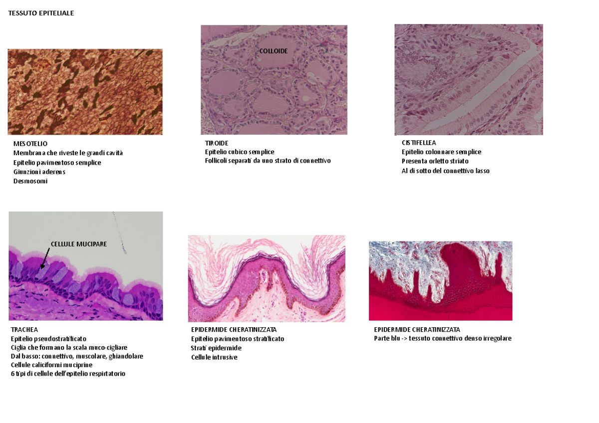 Intestino Con Epitelio Colonnare Semplice