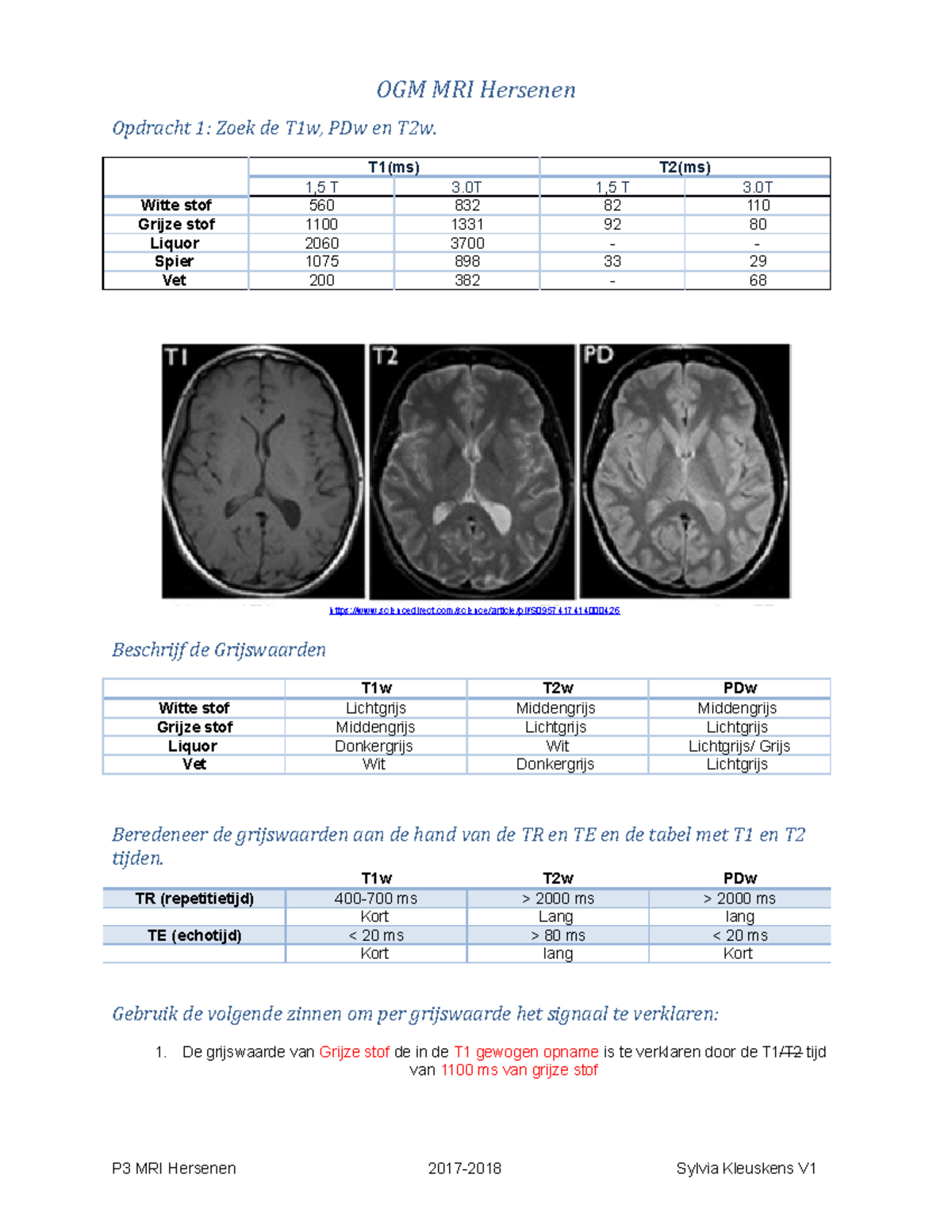 V MRI 03-10 MRI Hersenen in beeld - Opdracht 1: Zoek de T1w, PDw en T2w ...