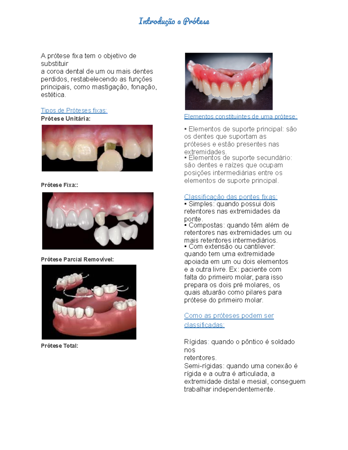 Reab Oral I Prótese - resumo - A prótese fixa tem o objetivo de ...