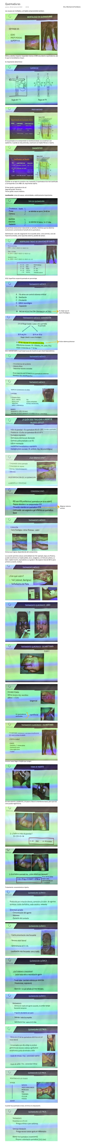 Anatomía de la región Inguinal - 1 ANATOMÍA DE LA REGIÓN INGUINAL Con ...