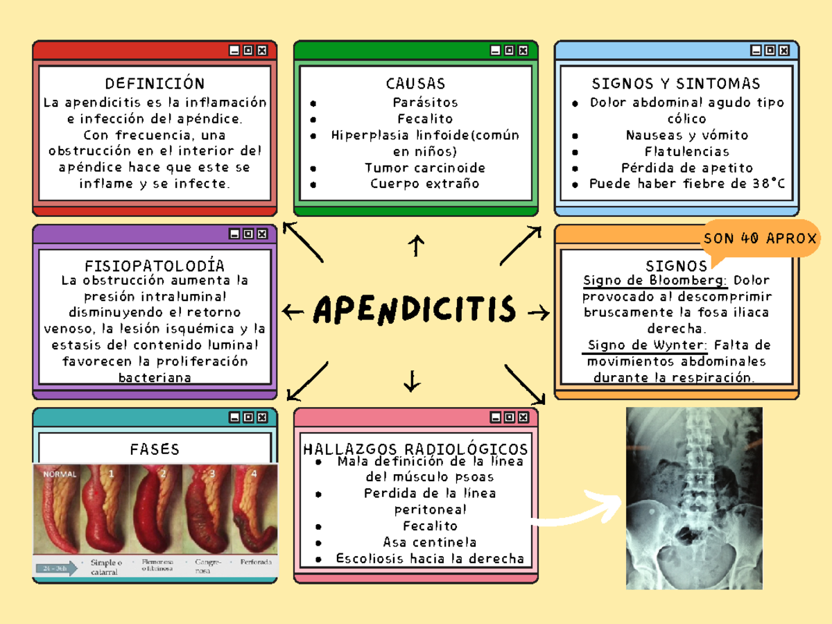 Mapa apendicitis - se describe y menciona la clinica de éste - APENDICITIS SON 40 APROX ...