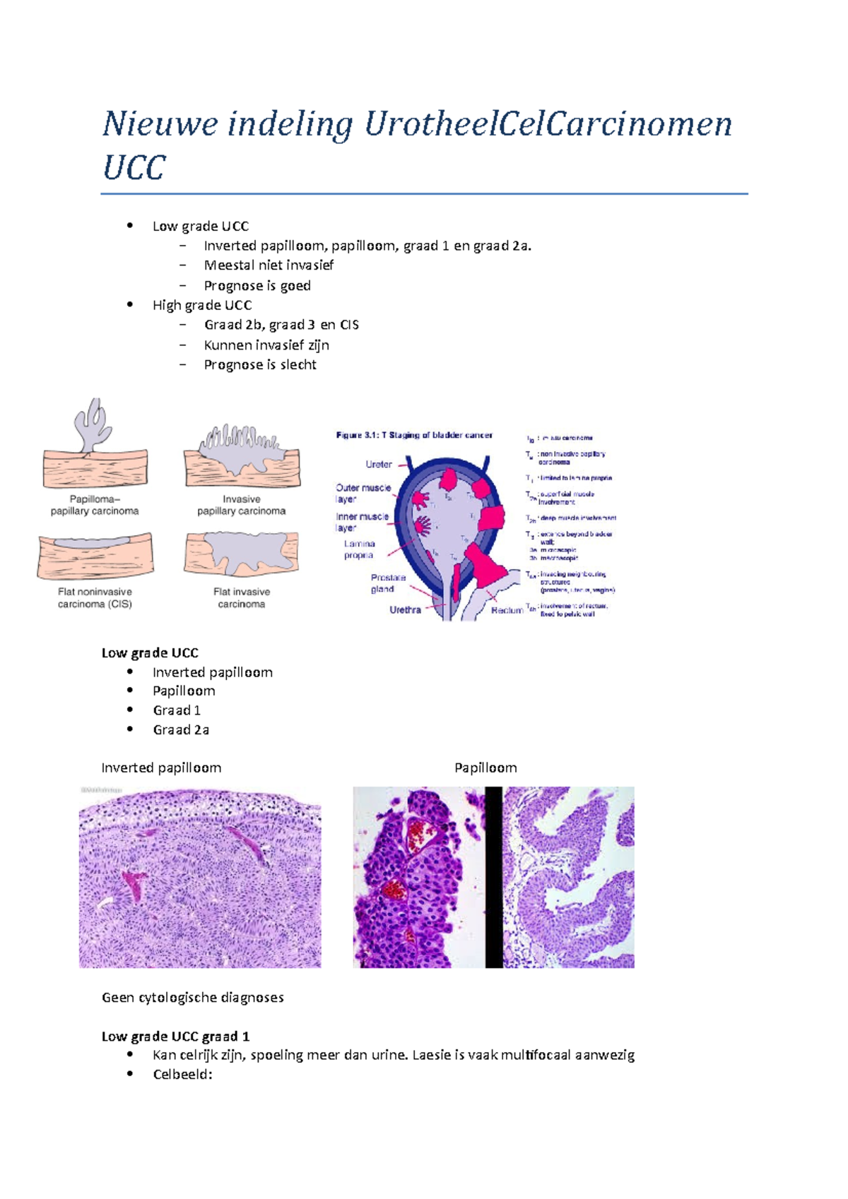 Nieuwe indeling Urotheel Cel Carcinomen UCC - Nieuwe indeling ...