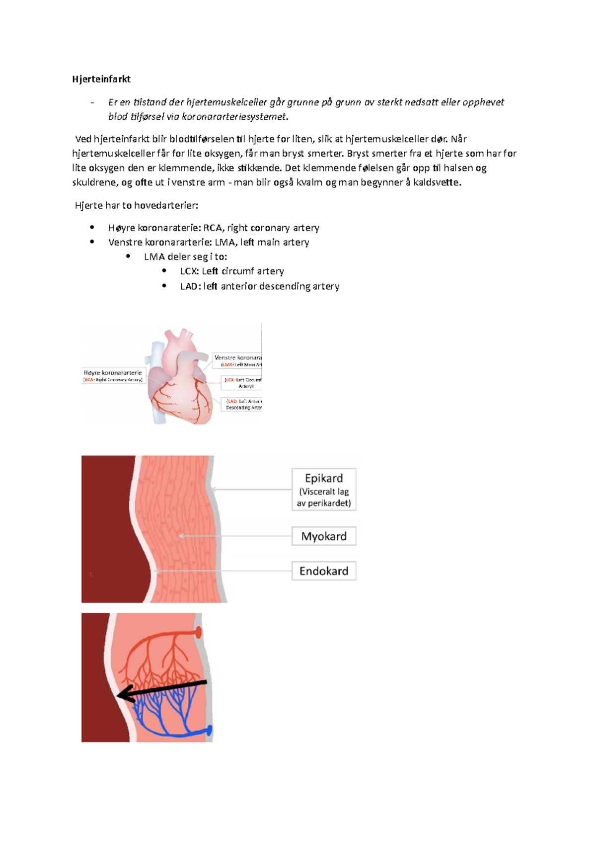 Hjerteinfarkt - Oversiktlig. - Hjerteinfarkt - Er en tilstand der ...
