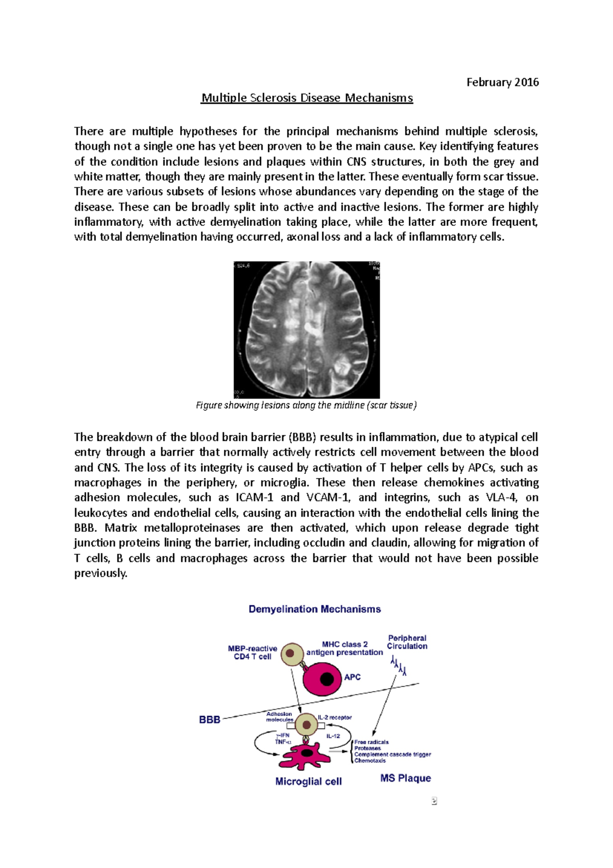 Multiple Sclerosis Summary Sheet - February 2016 Multiple Sclerosis ...