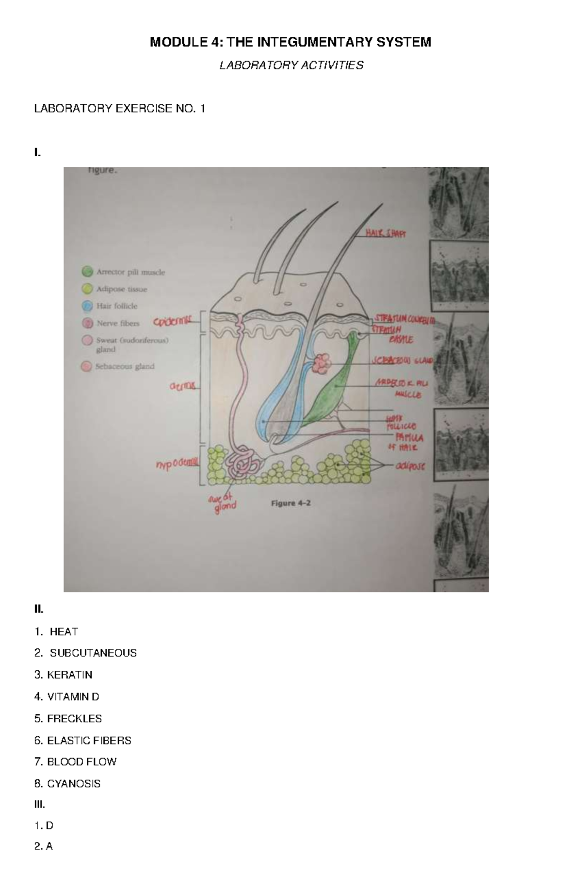 Dela Cruz, Virgilio Module 4 Laboratory Activity - MODULE 4: THE INTEGUMENTARY SYSTEM LABORATORY ...
