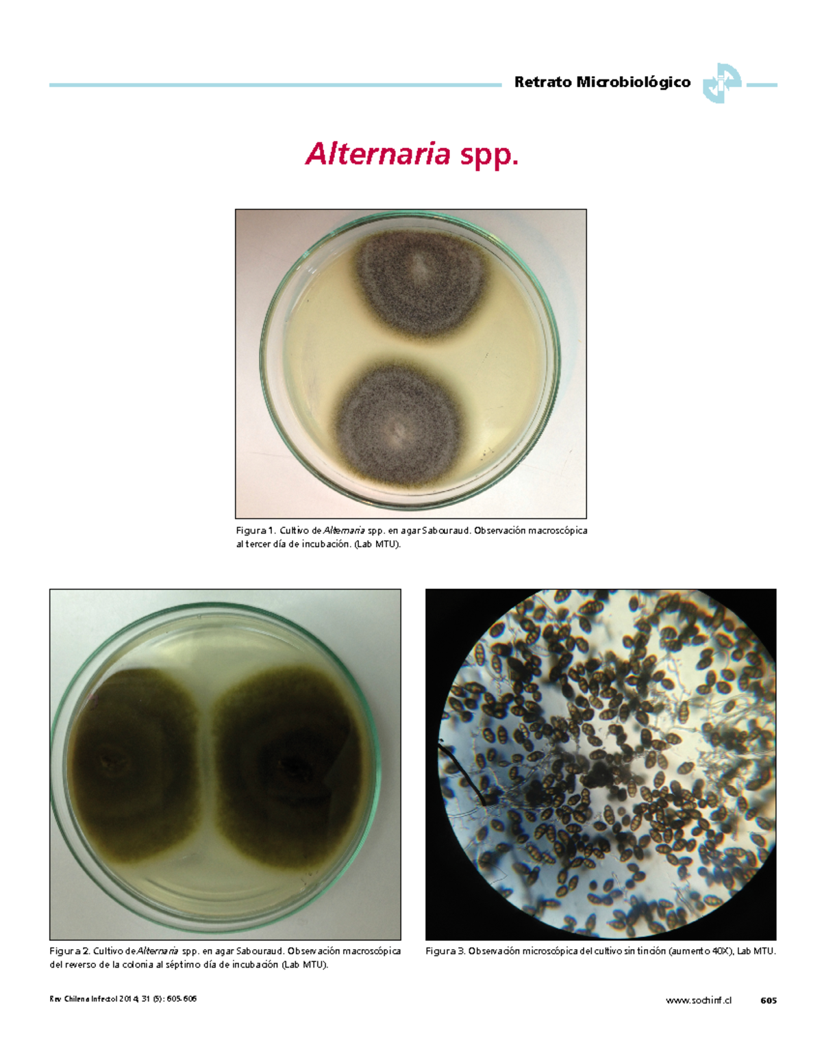 Alternaria spp - MICROSCOPIO - bioquimica - Retrato Microbiológico sochinf 605 Alternaria spp ...