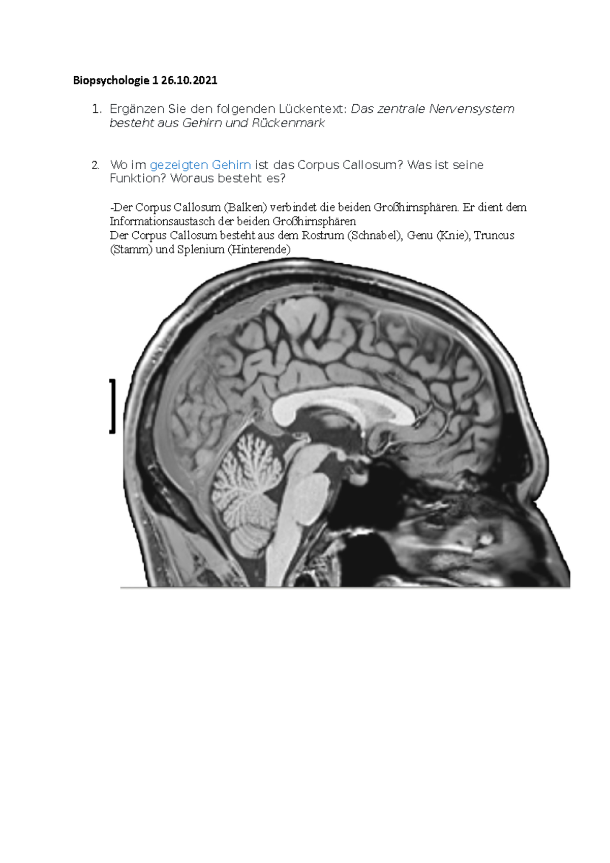 NS,Gehrin,Cortex - Biopsychologie 1 26. Ergänzen Sie den folgenden ...