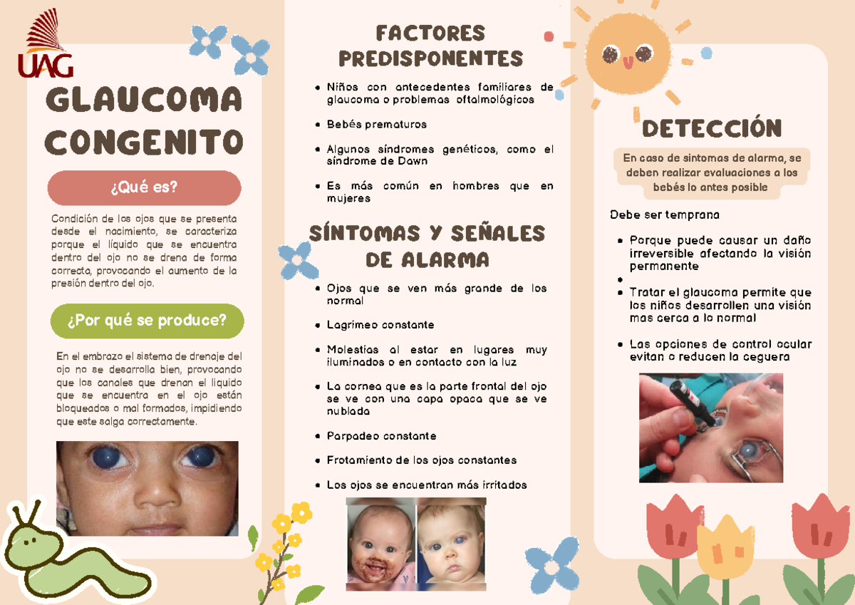 Glaucoma congenito - tríptico - ¿Qué es? ¿Por qué se produce? DETECCIÓN ...