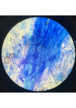 A little about Third Spacing - Intracellular- fluid contained within ...