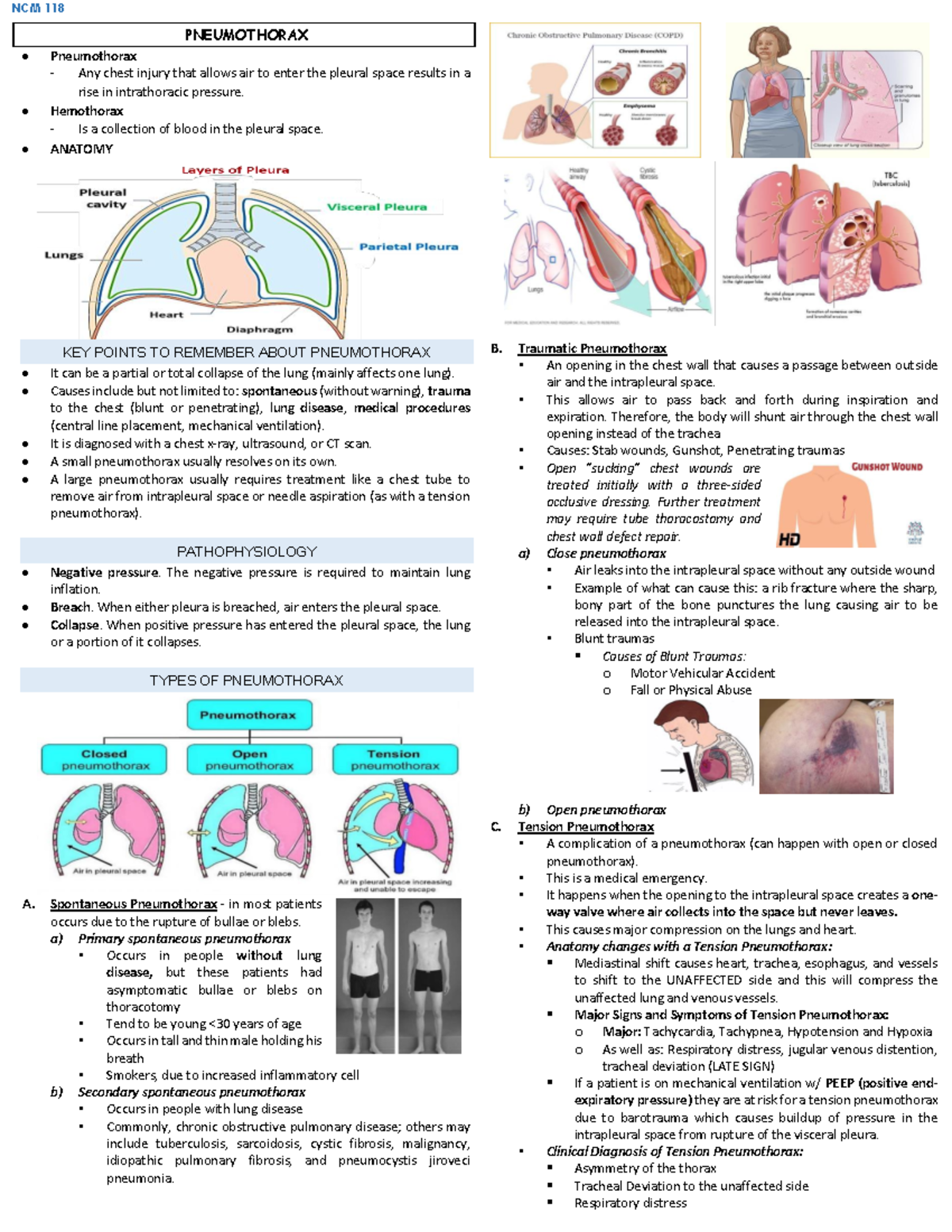 NCM 118 Pneumothorax ARF ARDS - PNEUMOTHORAX Pneumothorax - Any chest ...