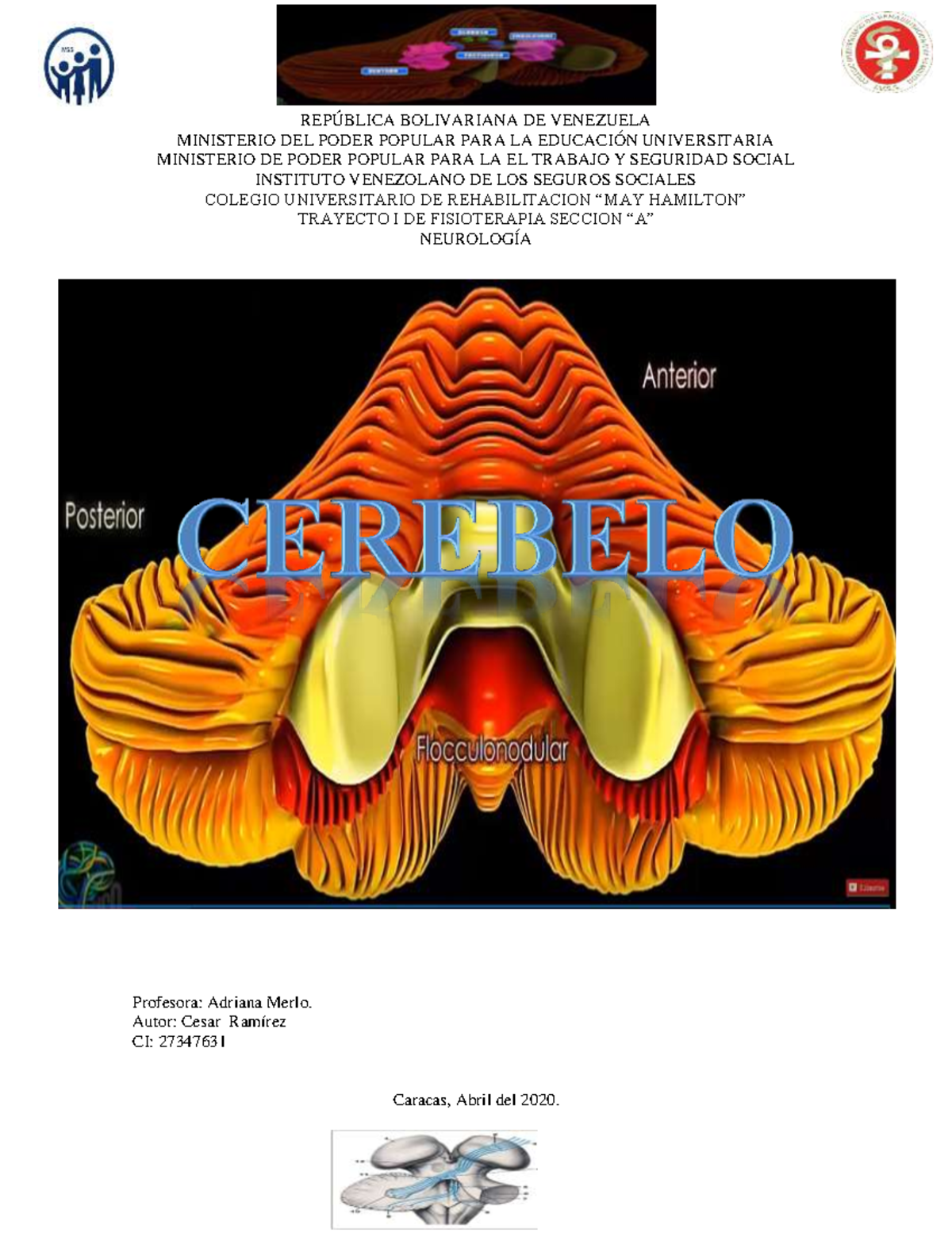 Cerebelo - Warning: TT: undefined function: 22 REPÚBLICA BOLIVARIANA DE VENEZUELA MINISTERIO DEL ...