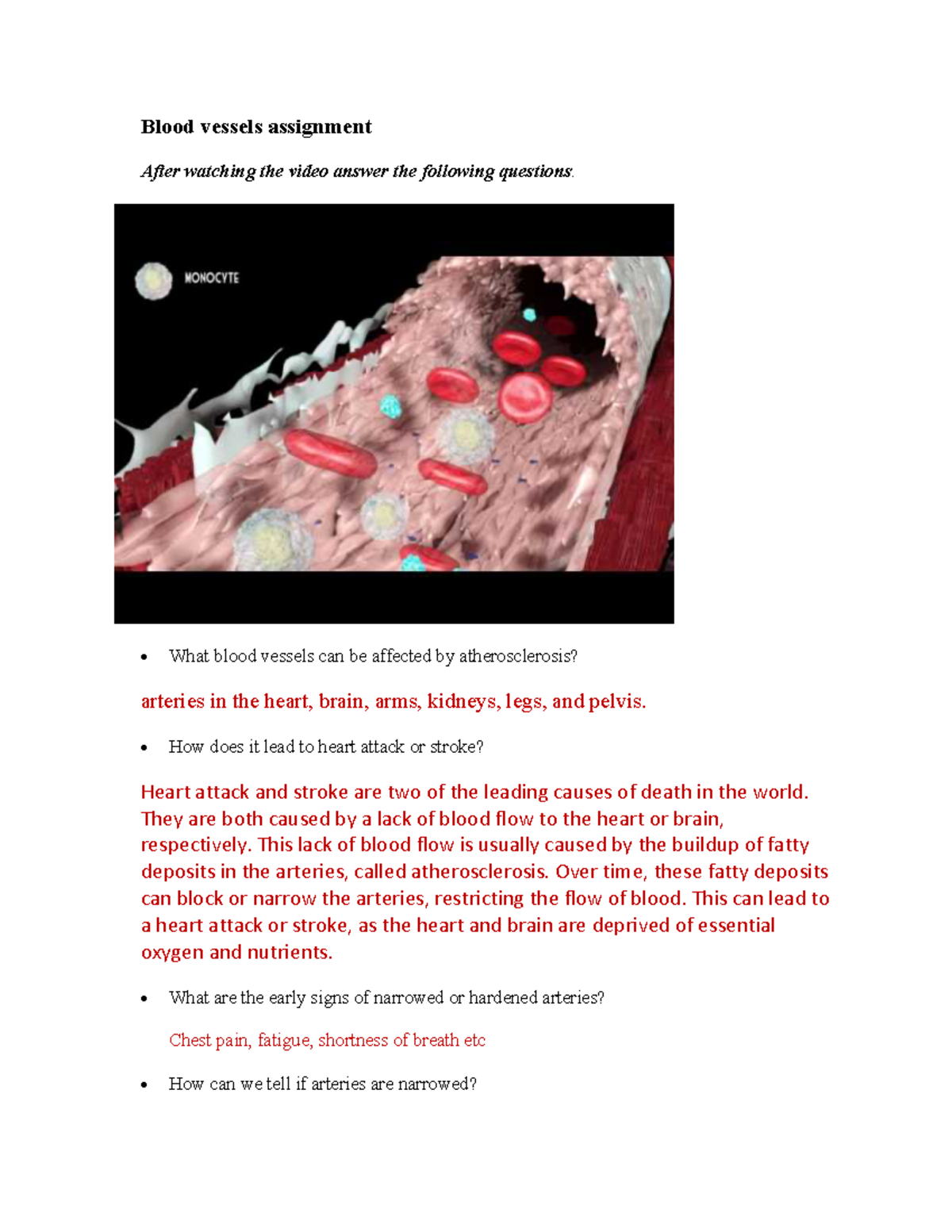 Blood vesseles assignment - Blood vessels assignment After watching the ...